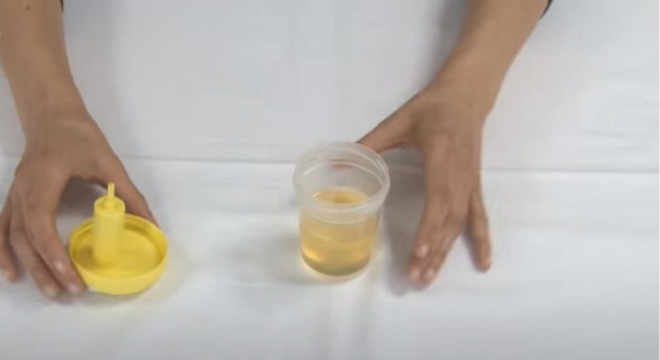 Pipì che puzza: tutte le possibili cause dell'urina maleodorante