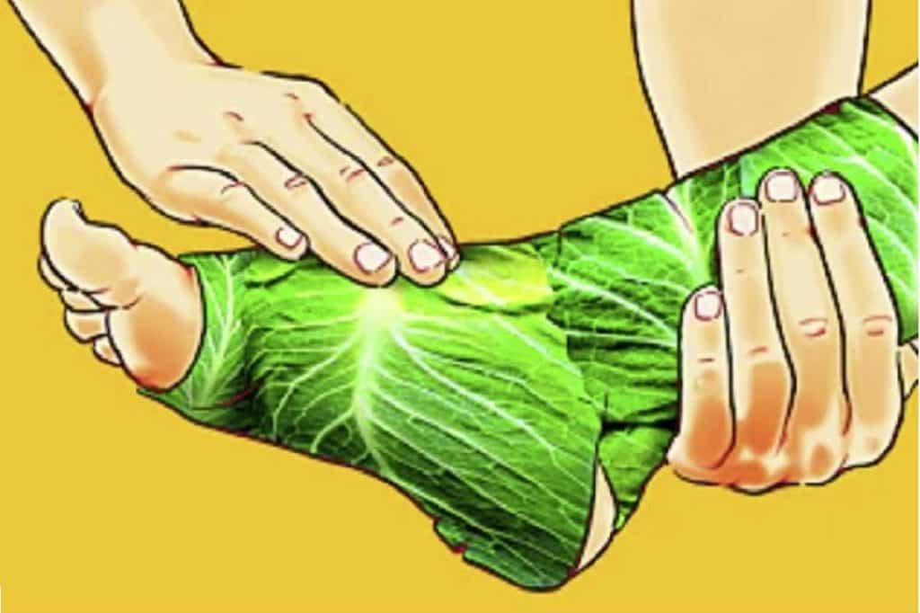 Impacchi di verza: un miracolo contro dolori articolari e muscolari